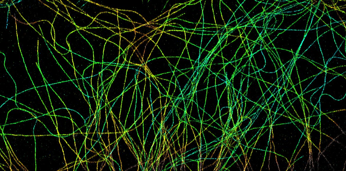 Research - Bioimaging and Biophotonics Laboratory